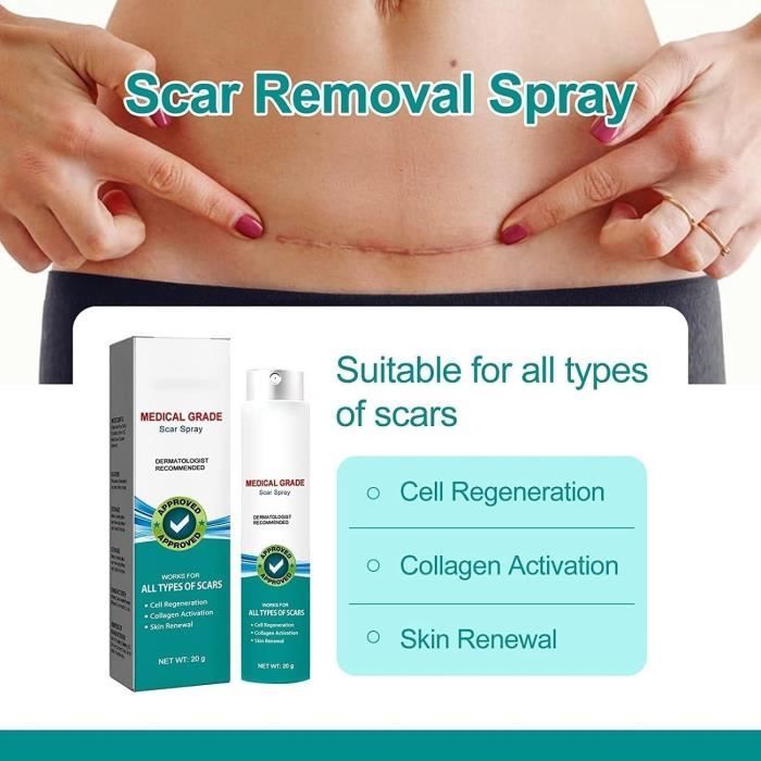 Advanced Scar Spray,Scar Remove Advanced Scar Spray for All Types of ...