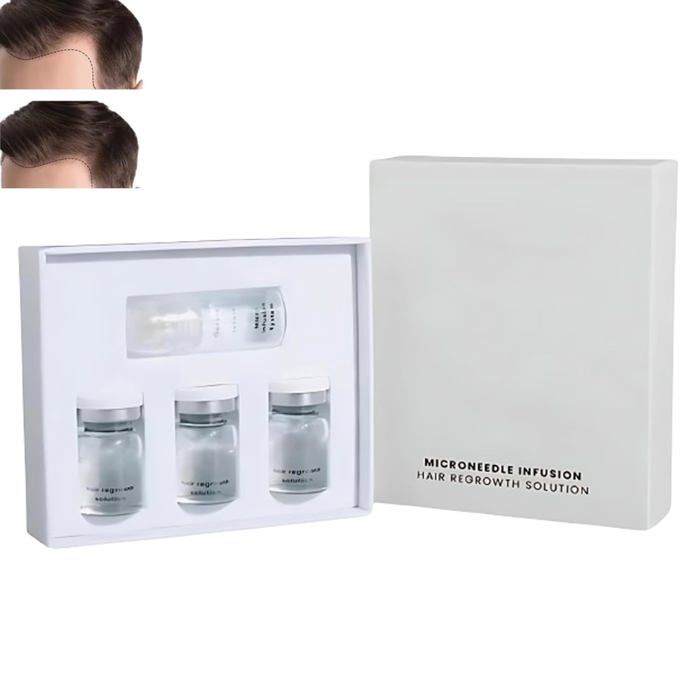 Alphainfuse Hair Regrowth System, Alpha Infuse Hair Regrowth ...
