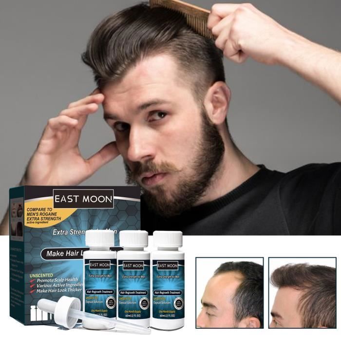 Hair Regen Advanced Hair Regrowth Treatment for Men , Hair Loss ...