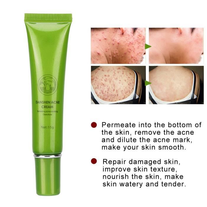 Traitement de l'acné Crème anti-acné MABREM Lotion rafrachissante ...