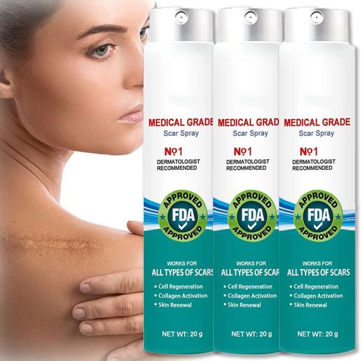 Advanced Scar Spray For All Types Of Scars, Scar Remove Medical Grade ...