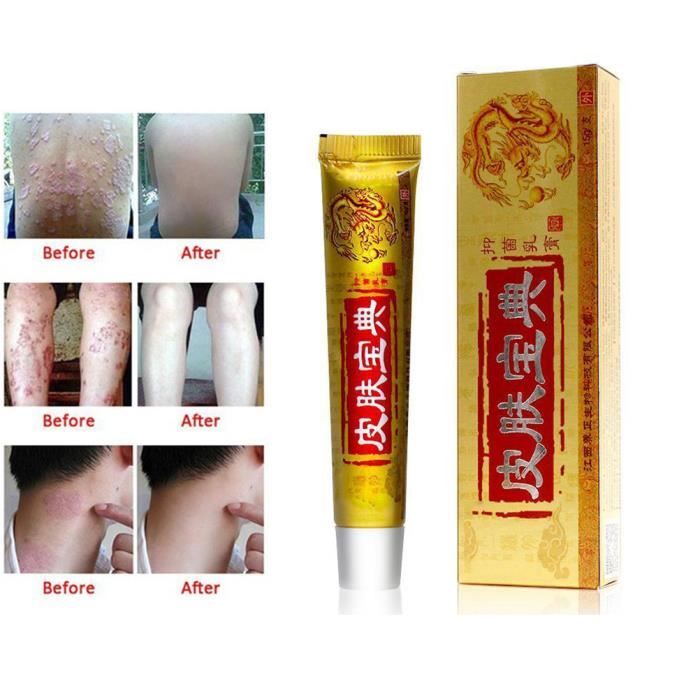 Omabeta Pommade cutanée Crème de médecine chinoise, pommade pour la ...