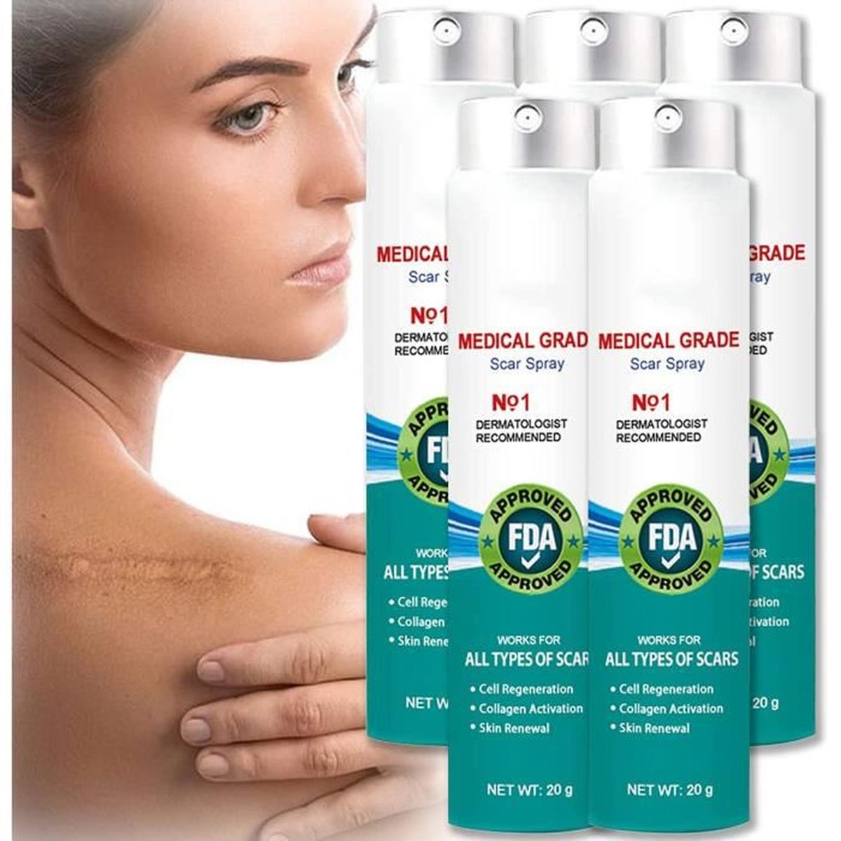 Advanced Scar Spray For All Types Of Scars, Scar Remove Medical Grade ...