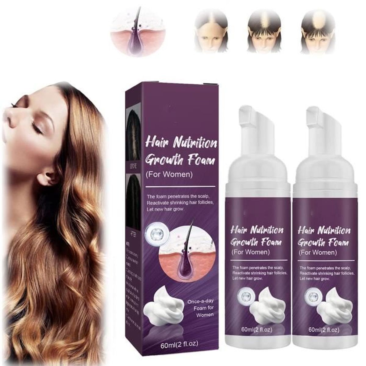 Hair-revive Foam Shampoo, Hair Foam Shampoo, Hair Regrowth Treatment ...
