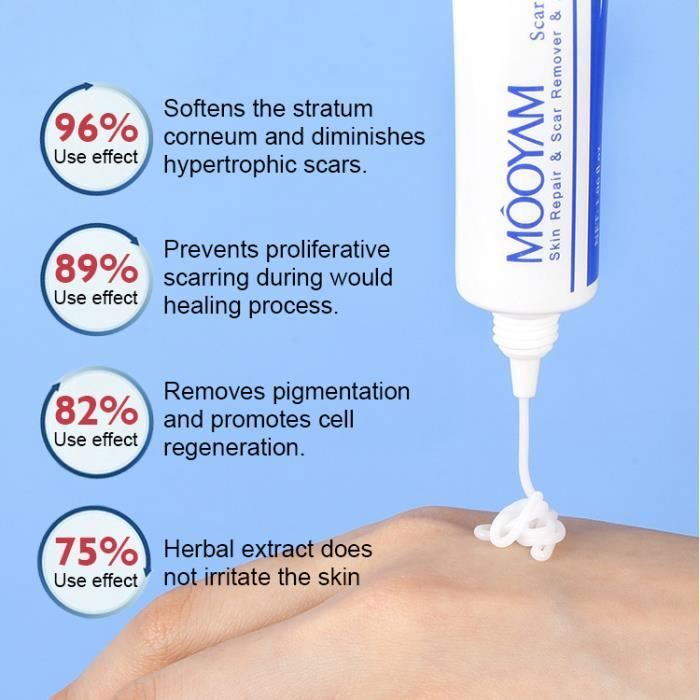 MOOYAM Herbal Scar Removal Cream Gel Repair Pock Mark Burn Cicatrice ...