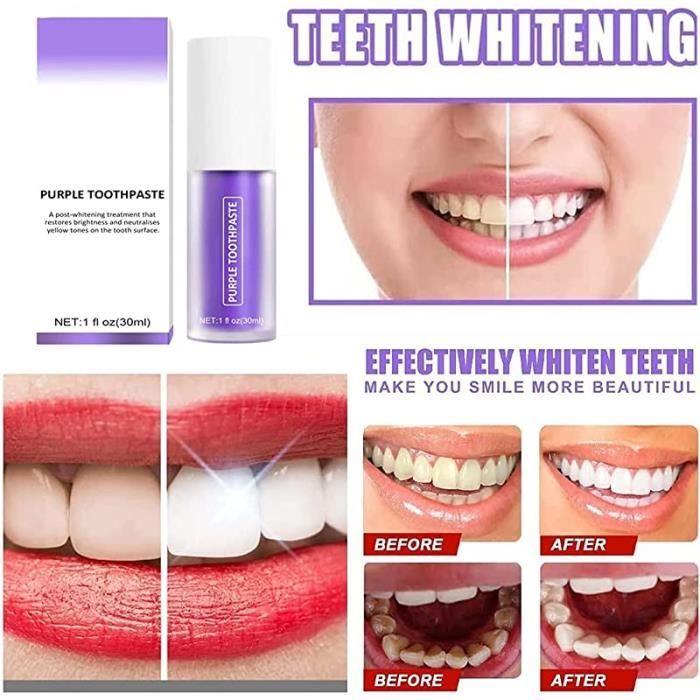 Dentifrice - V34 - Blanchissant Violet - Vegan - Nettoyage en ...