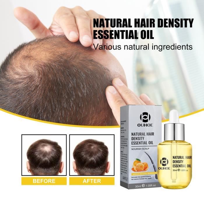 The Ultimate Hair Growth Oil, Hair Density Essential Oil, For Men Women ...