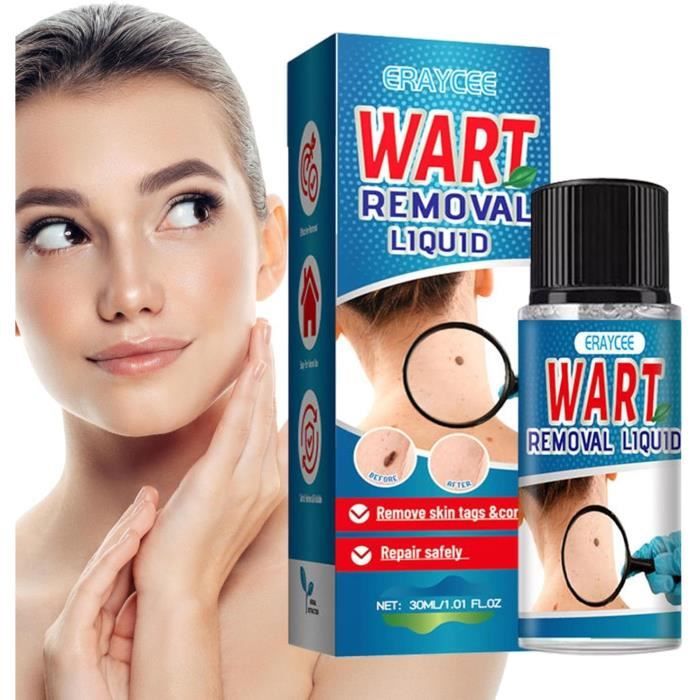 Azote Liquide - Traitement Verrues - 3pcs - Formule Naturelle - Peau ...